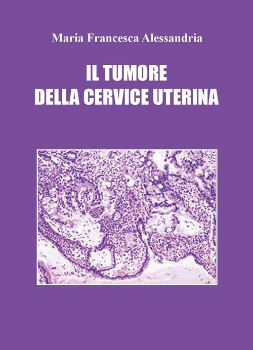 Il tumore della cervice uterina - Maria Francesca Alessandria - Libro Youcanprint 2023 ...